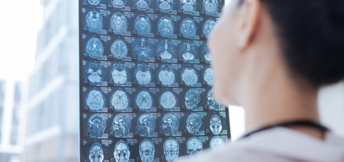 Achieving ALARA - Why are Patients, needing CT scan, Exposed to So Much ...